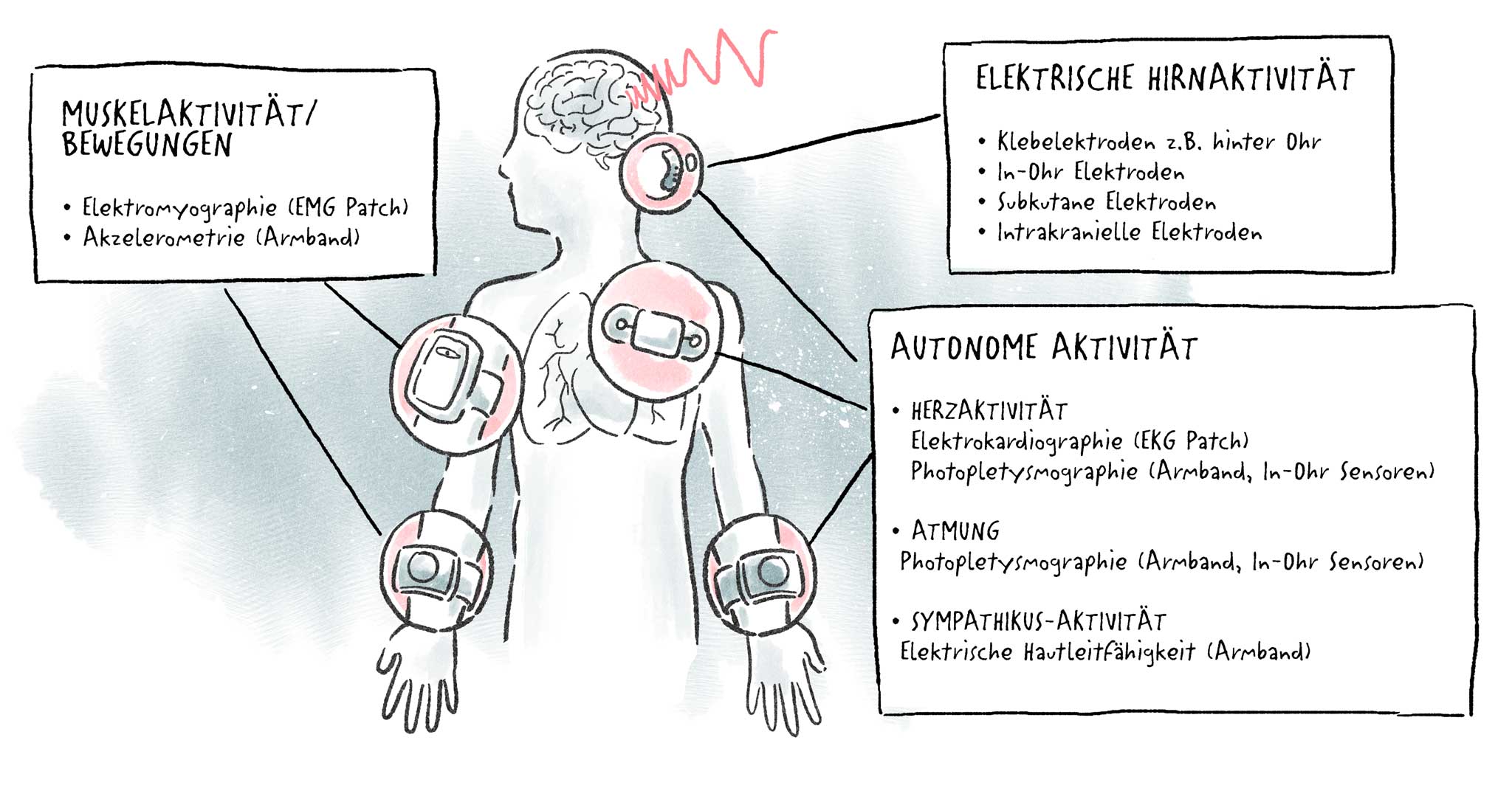 WAS IST SUDEP? - SUDEP.de